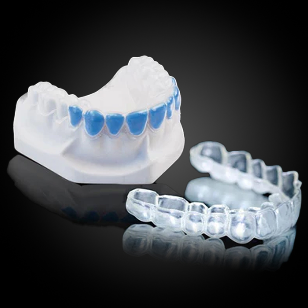 Bleaching Tray - XDENT LAB